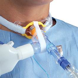 Antidisconnect Device, Tracheotomy, TrachStay | Tri-anim Health Services
